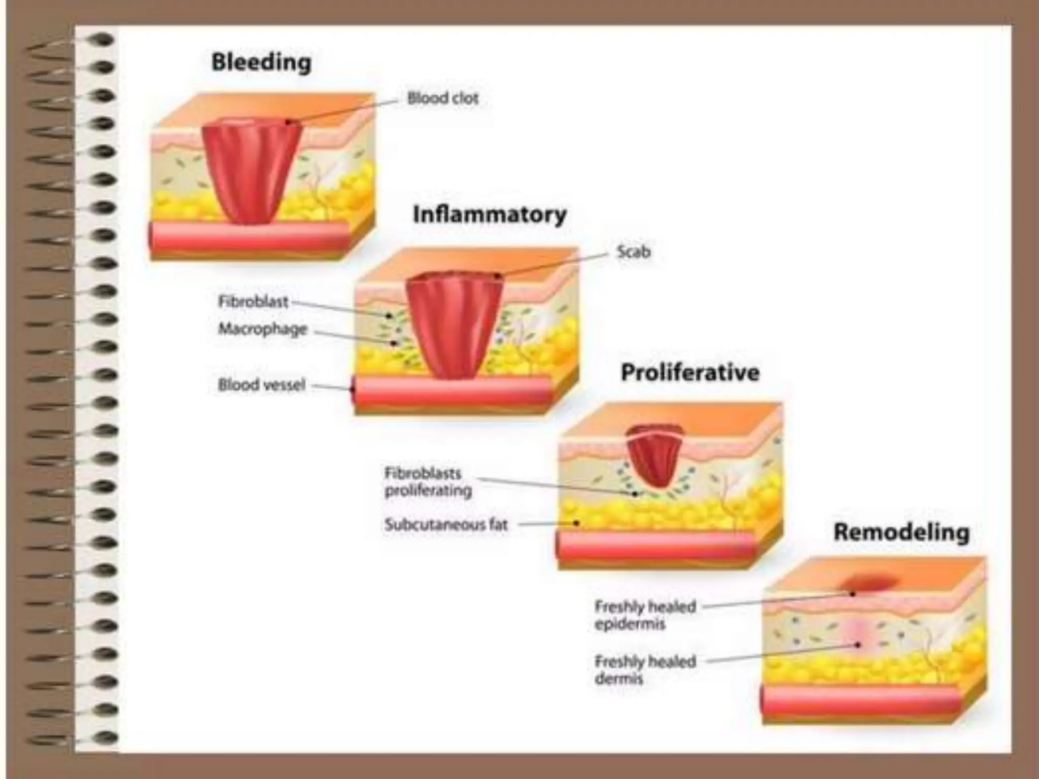 wounds, hemorrahge and shock.pptx for medical students | PPTX