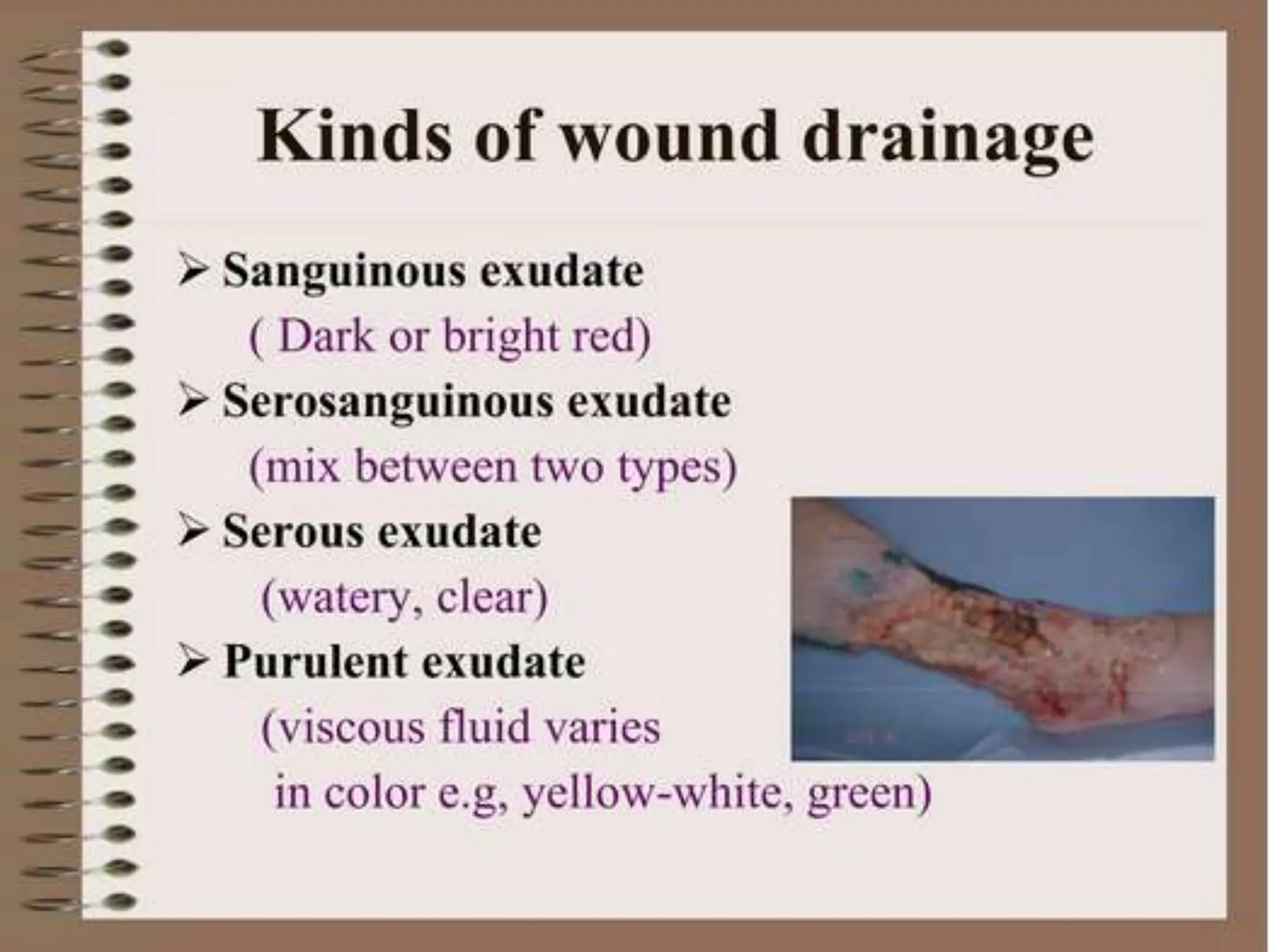 wounds, hemorrahge and shock.pptx for medical students | PPTX