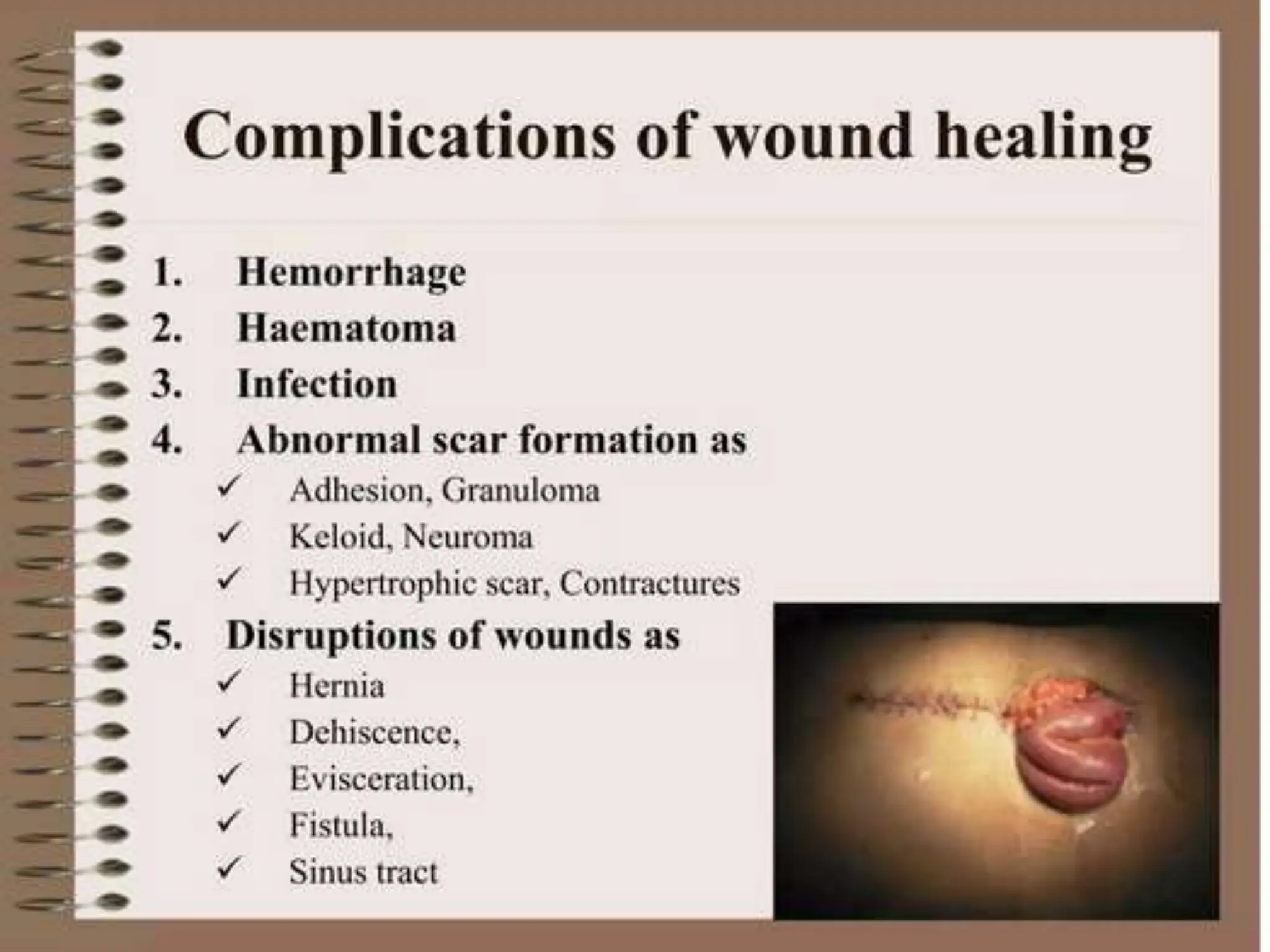 wounds, hemorrahge and shock.pptx for medical students | PPTX