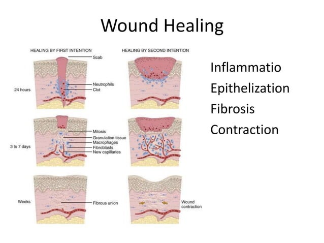 Wound & Stoma Management.pptx
