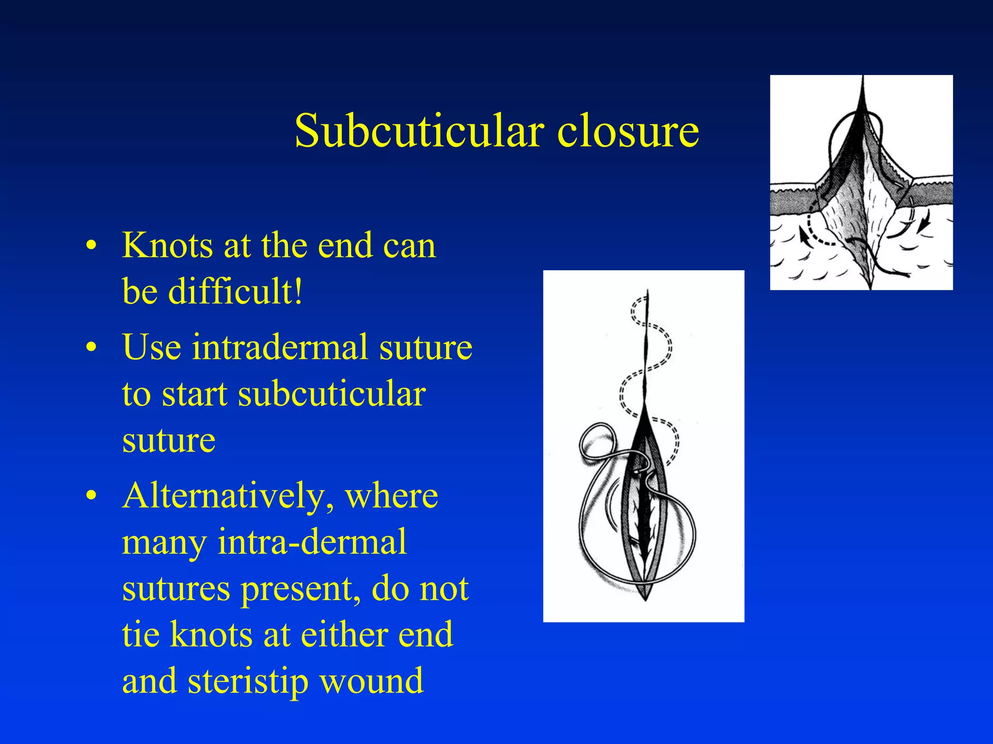 Wound Suturing & Skin Flaps May11 | PDF