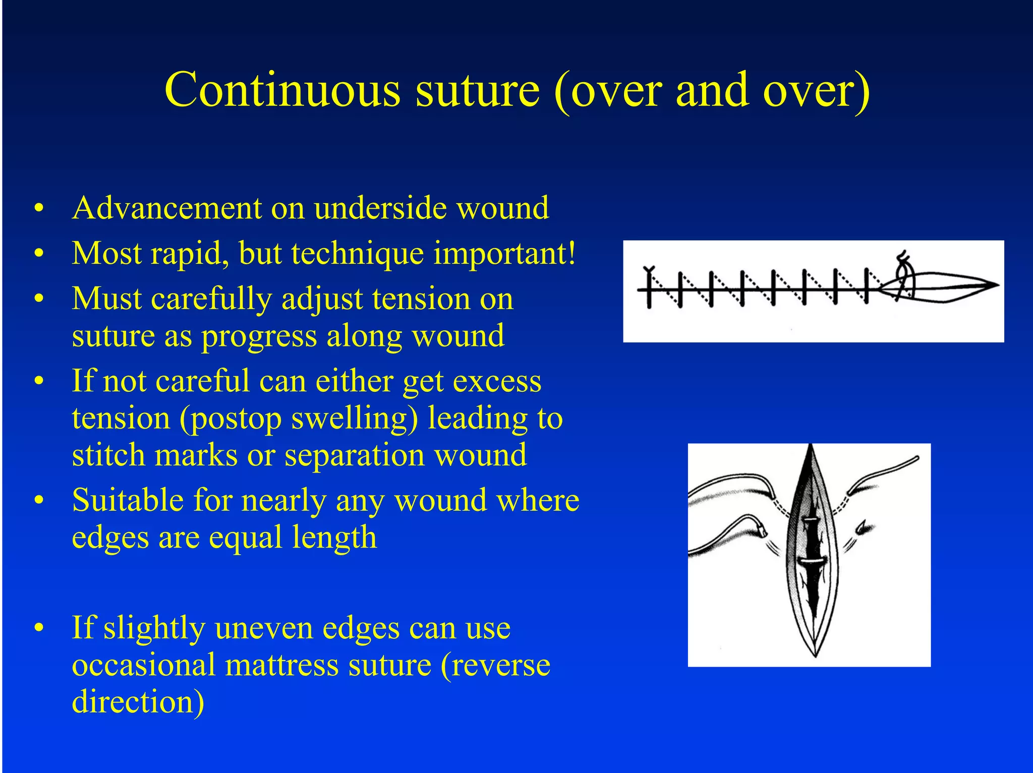 Wound Suturing & Skin Flaps May11 | PDF