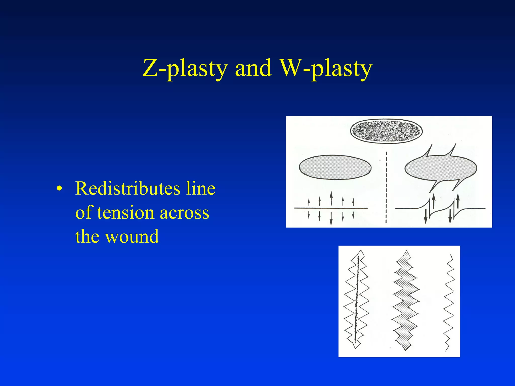 Wound Suturing & Skin Flaps May11 | PDF