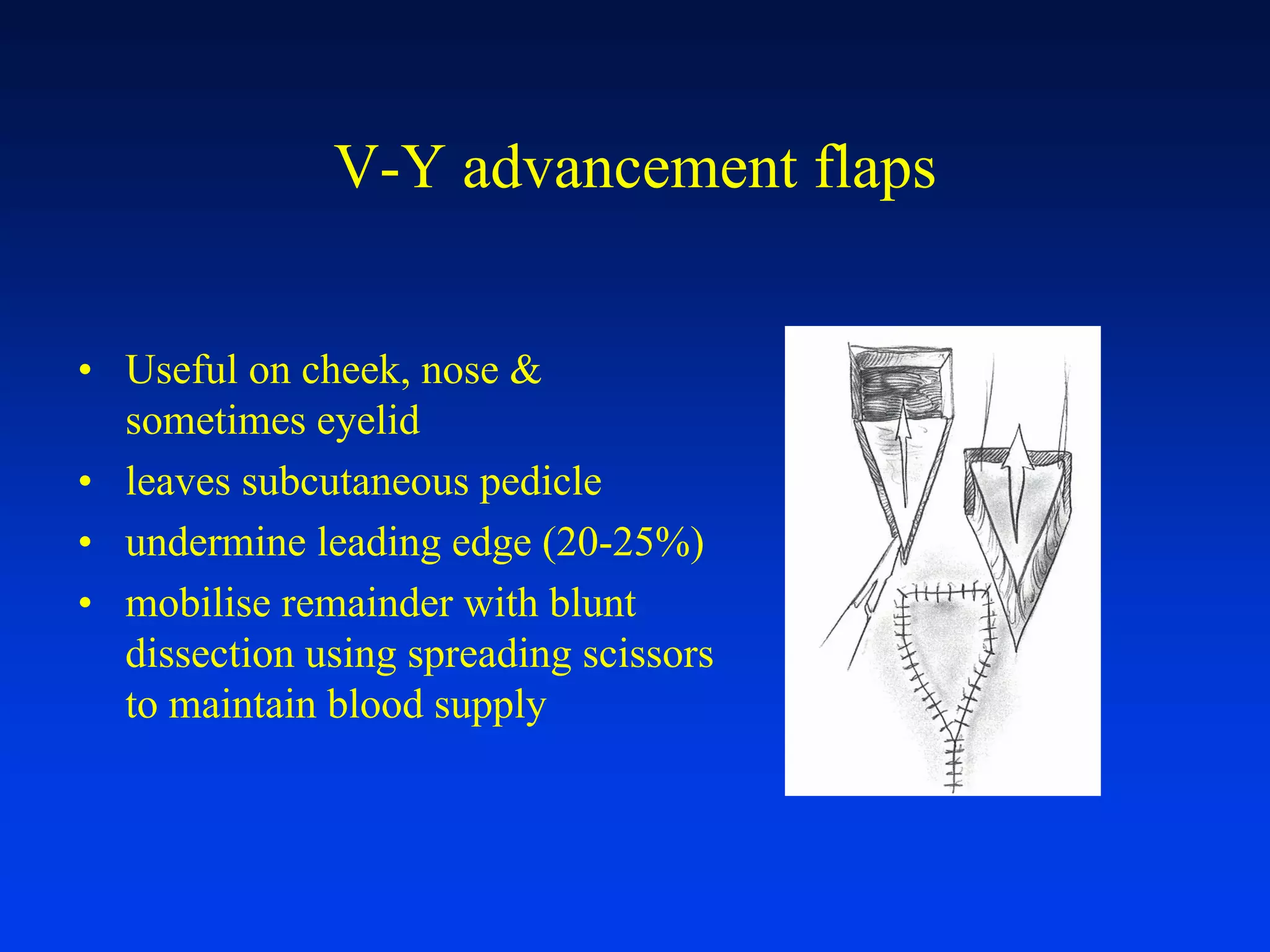 Wound Suturing & Skin Flaps May11 | PDF