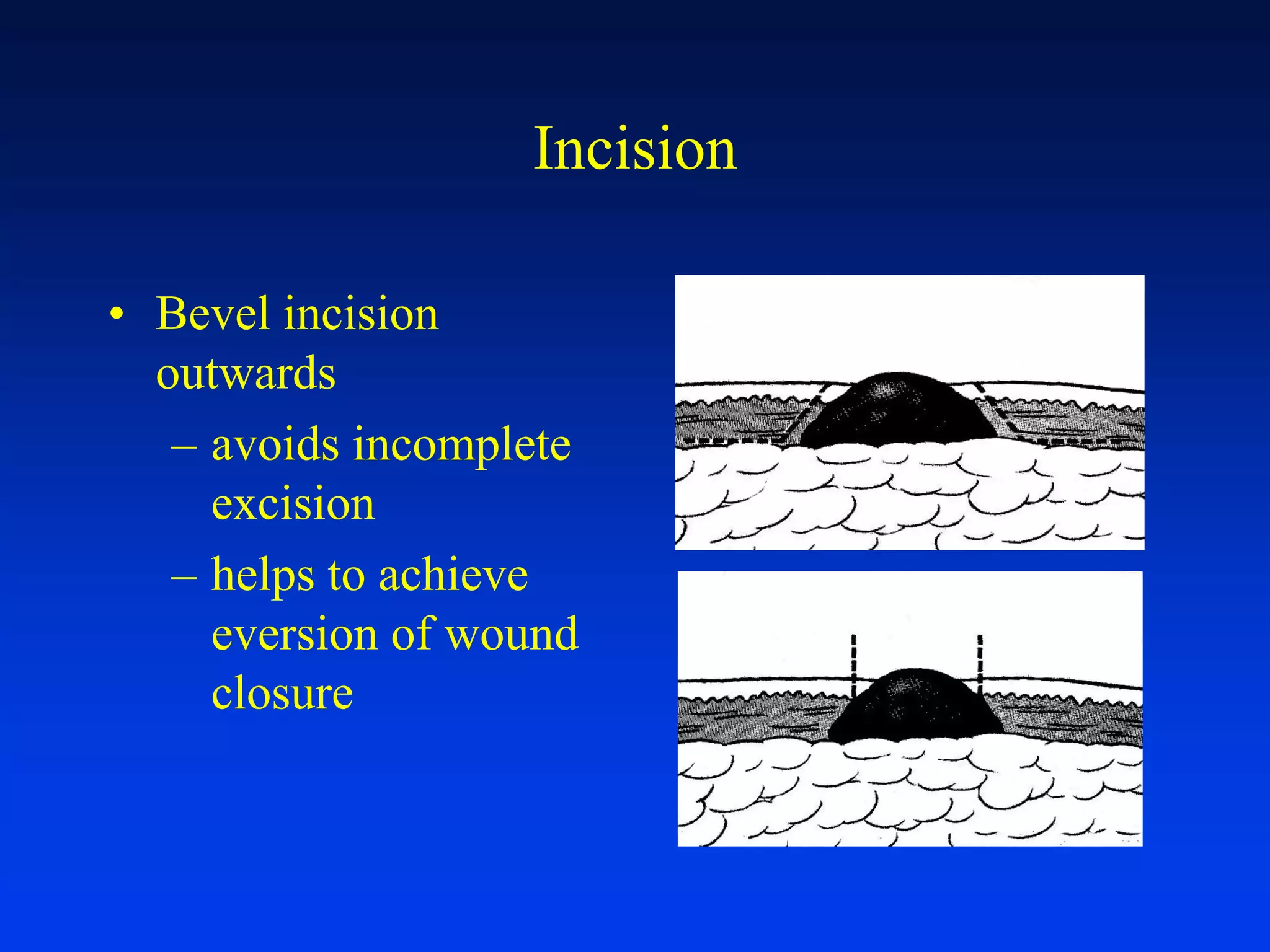 Wound Suturing & Skin Flaps May11 | PDF