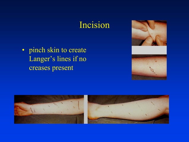 Wound Suturing & Skin Flaps May11 | PPT