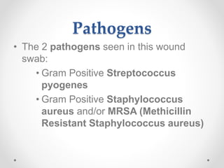 Wound Swab PowerPoint | PPTX