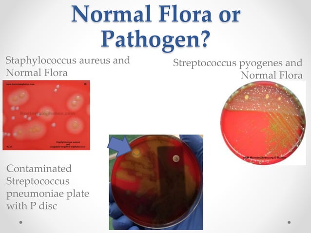 Wound Swab PowerPoint | PPT