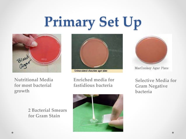 Wound Swab PowerPoint | PPT