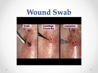 Wound swab mlt 2010 revised version | PPTX