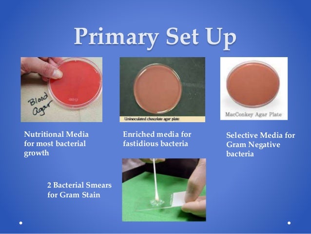 Wound swab mlt 2010 revised version