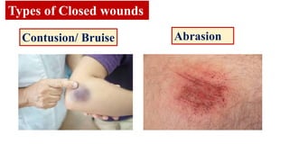 Wounds & Wound Assessment in nursing.pdf