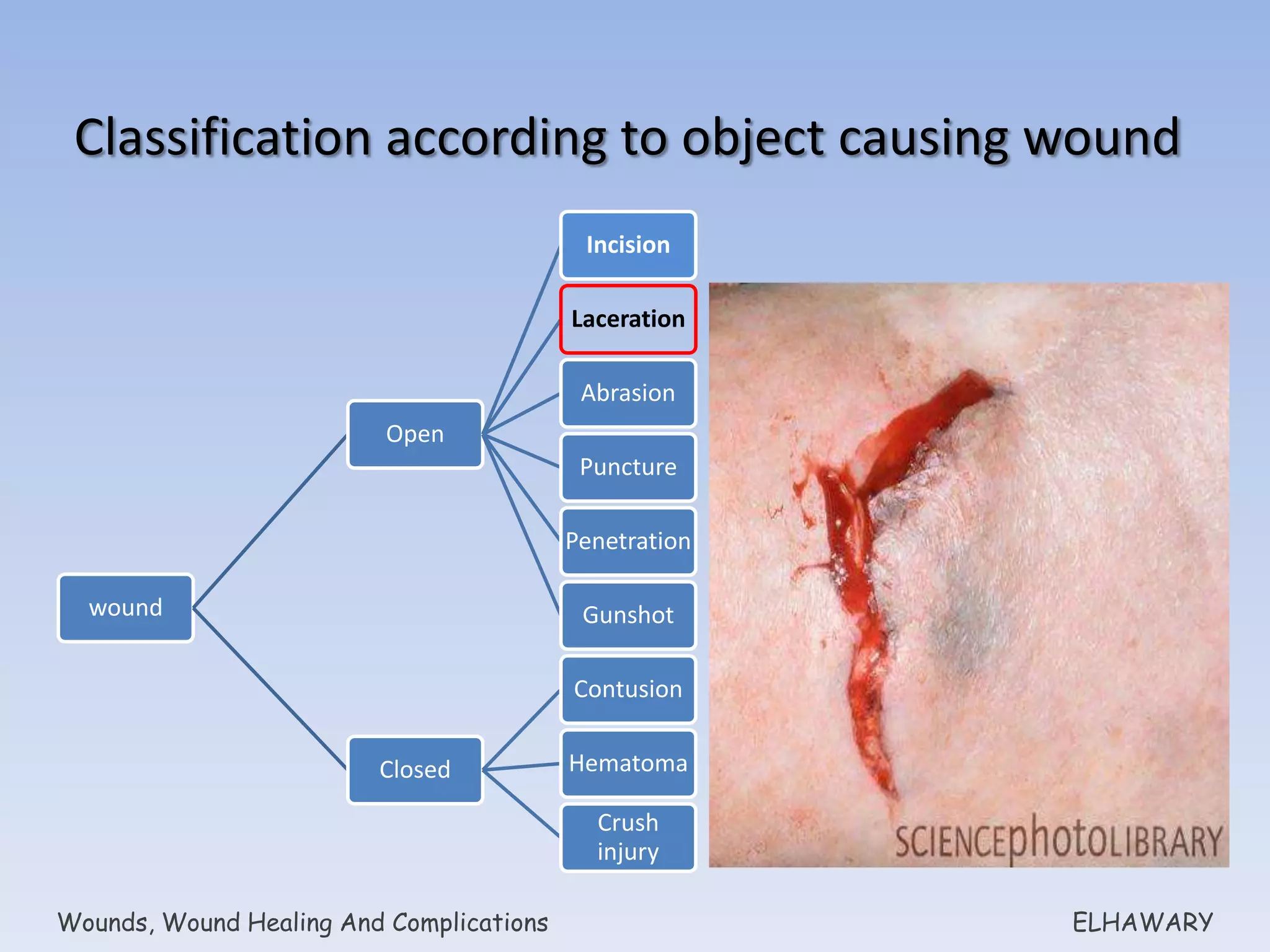 Wounds, wound healing and complications | PPTX