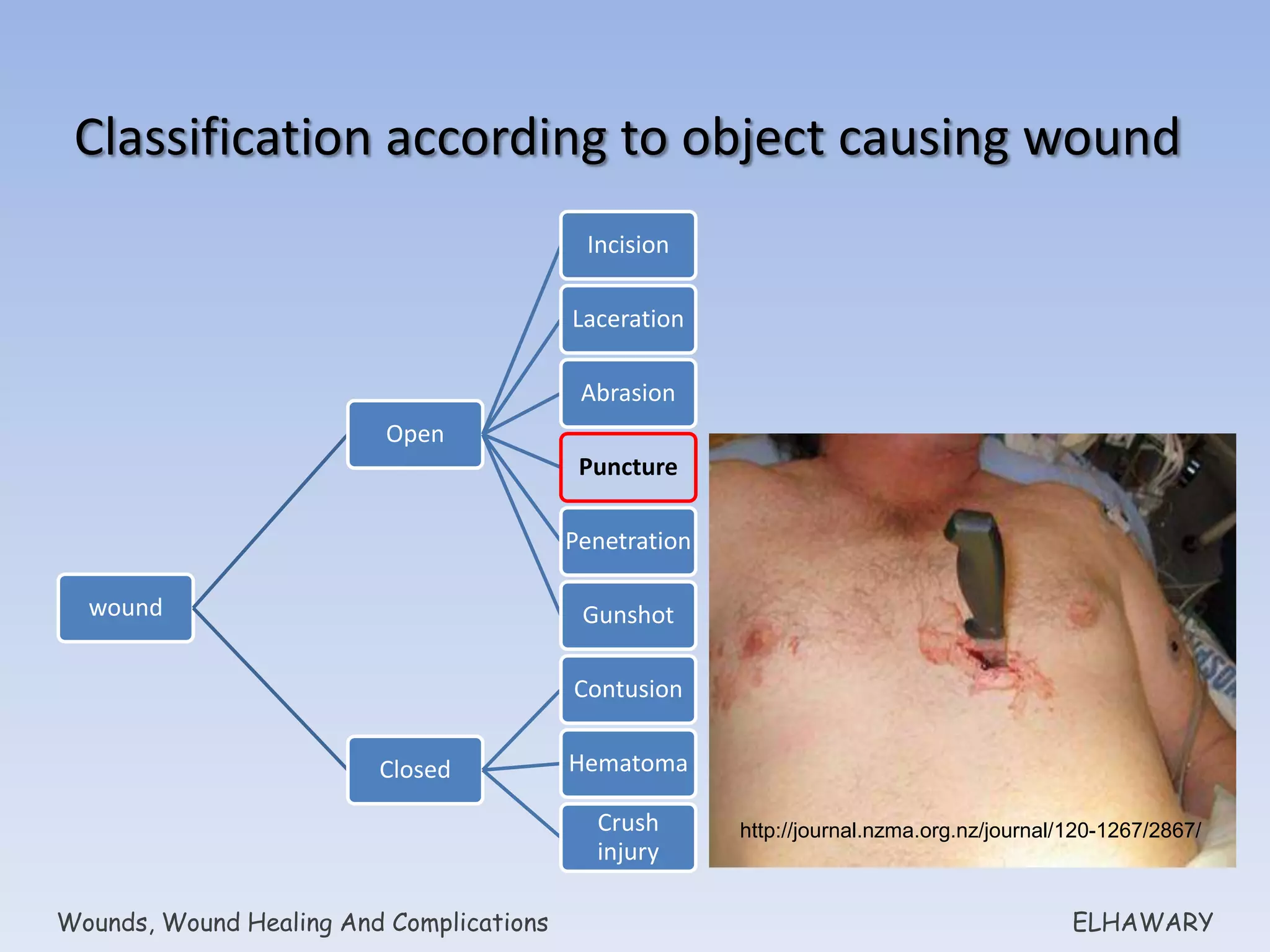 Wounds, wound healing and complications | PPTX