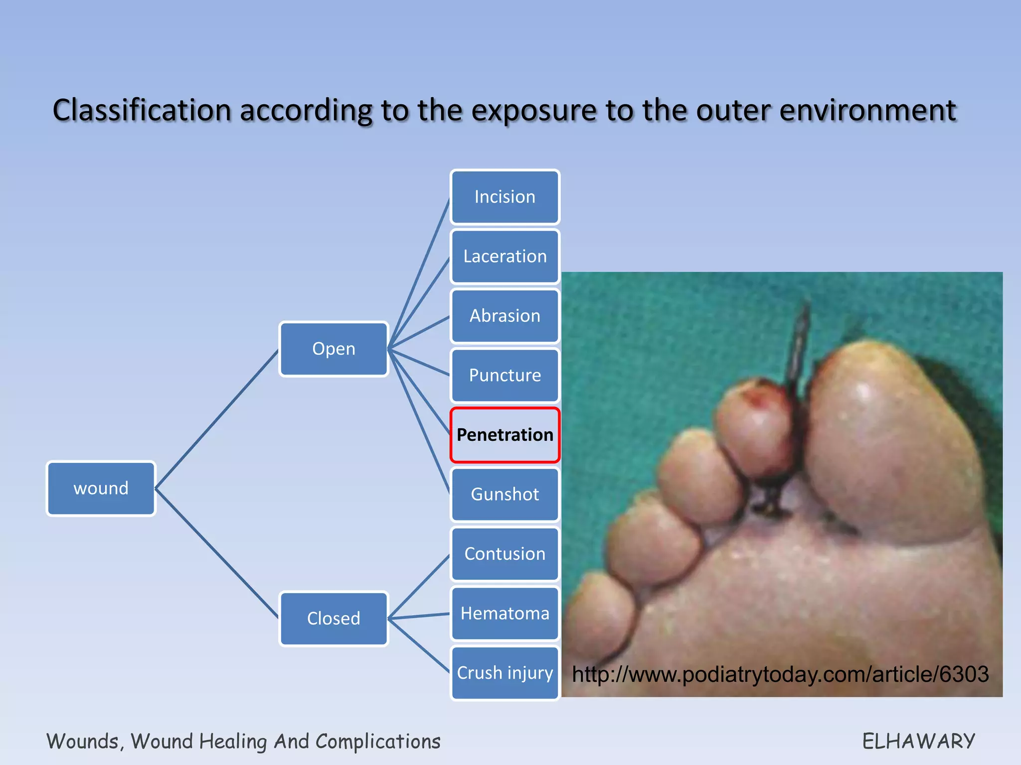 Wounds, wound healing and complications | PPTX