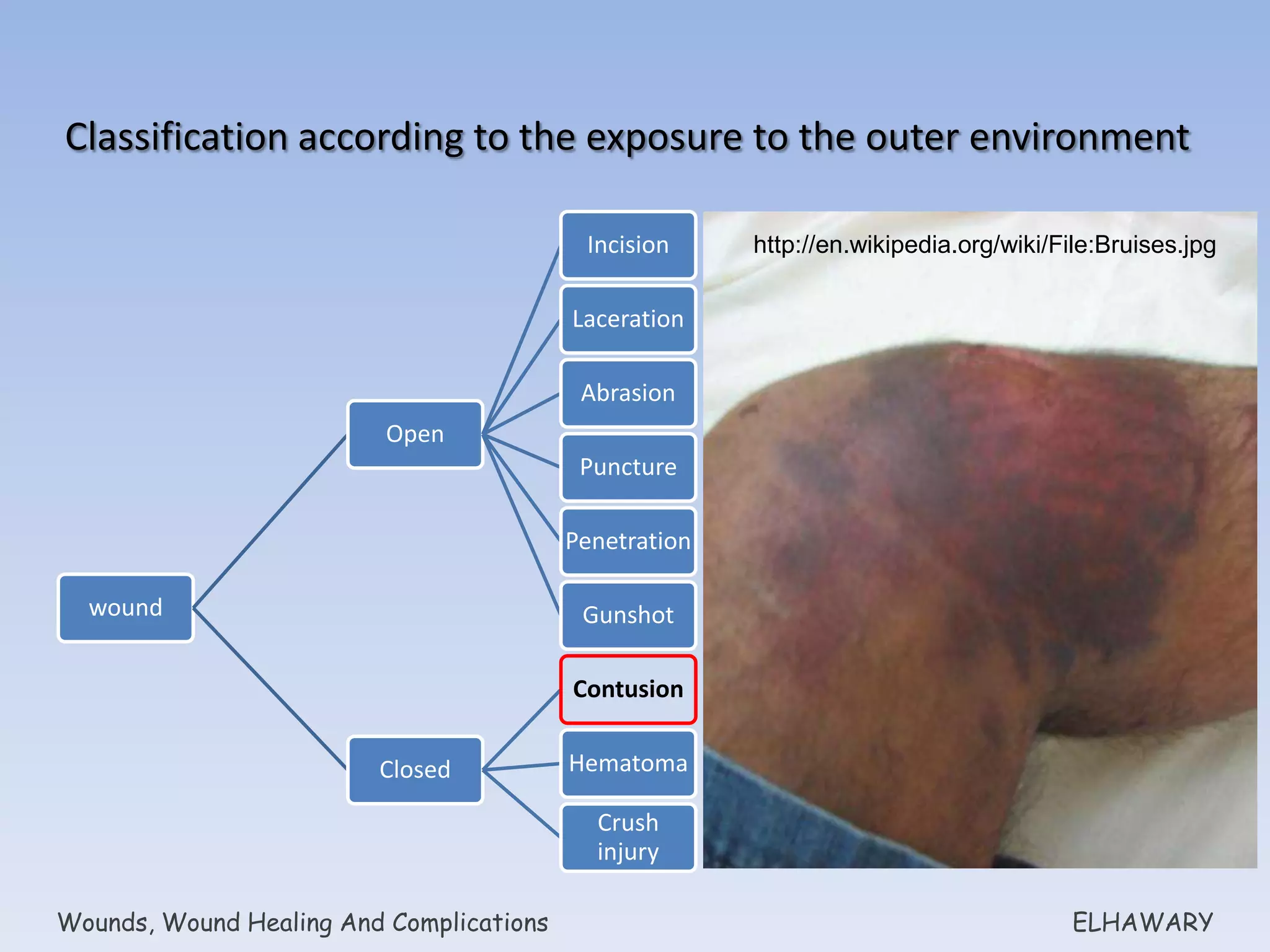 Wounds, wound healing and complications | PPTX