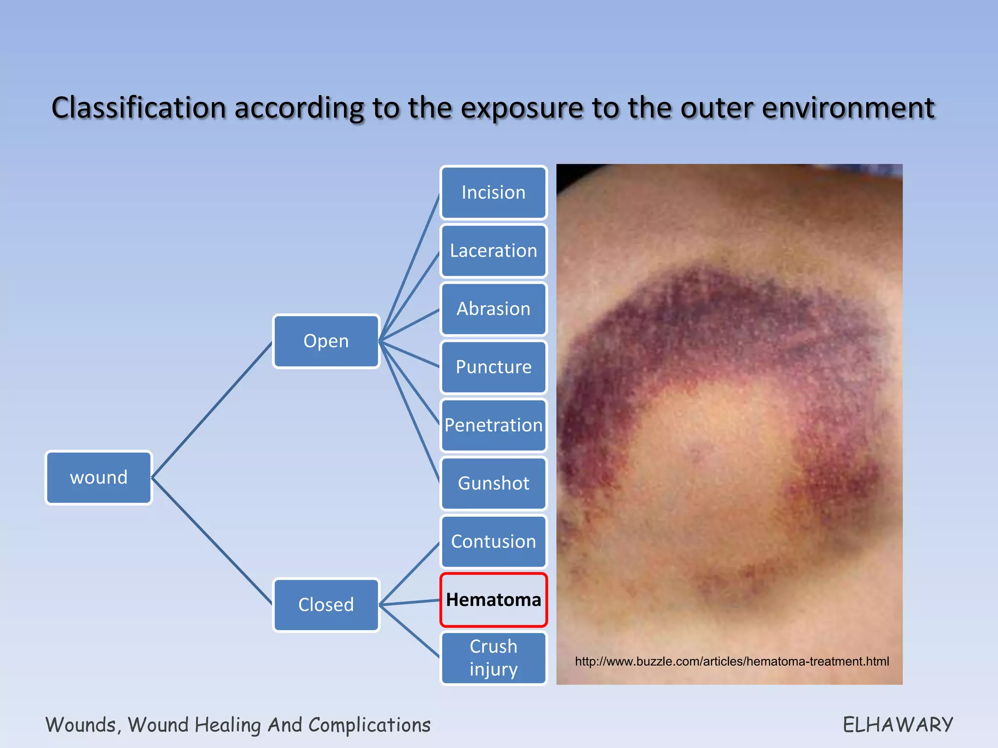 Wounds, wound healing and complications | PPTX