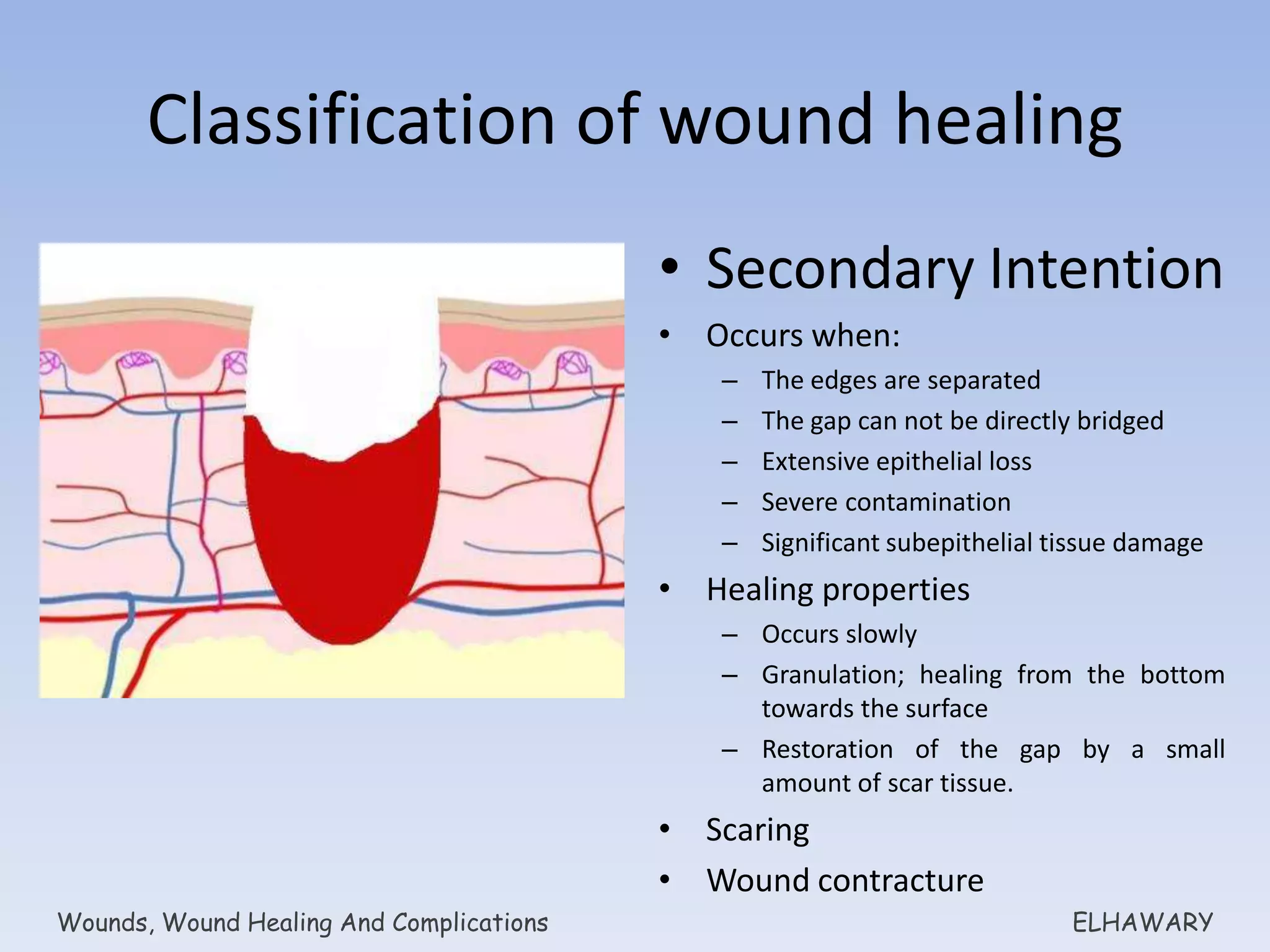 Wounds, wound healing and complications | PPTX