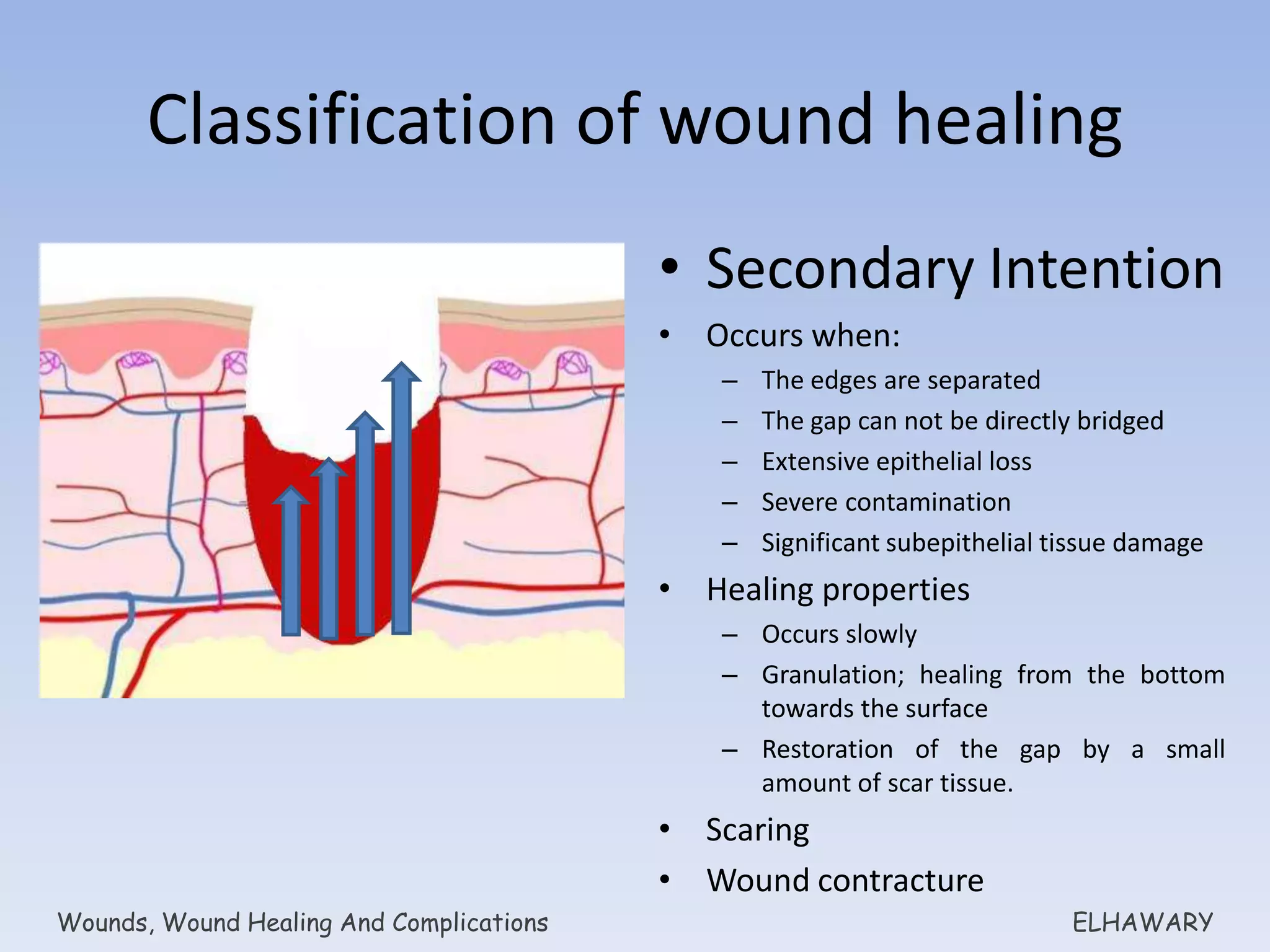 Wounds, wound healing and complications | PPTX