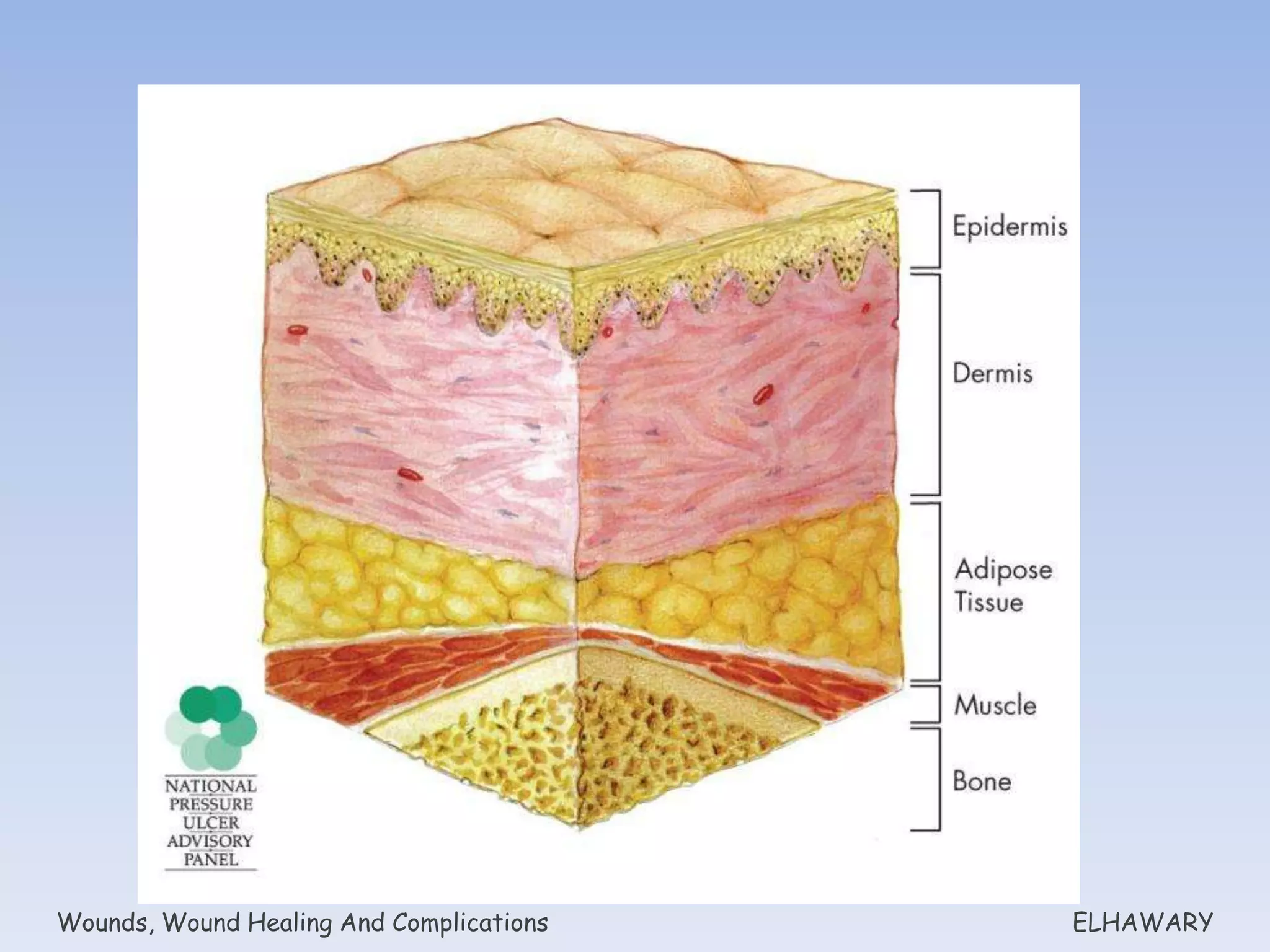 Wounds, wound healing and complications | PPTX