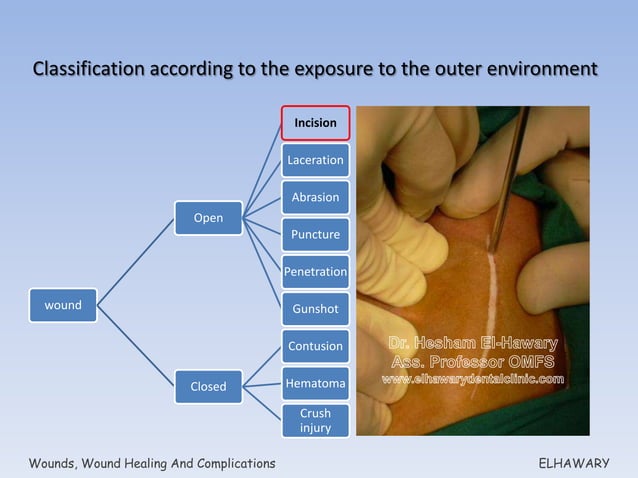 Wounds, wound healing and complications | PPTX | First Aid | Injuries