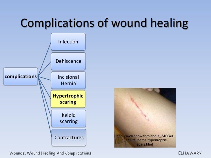 Wounds, wound healing and complications