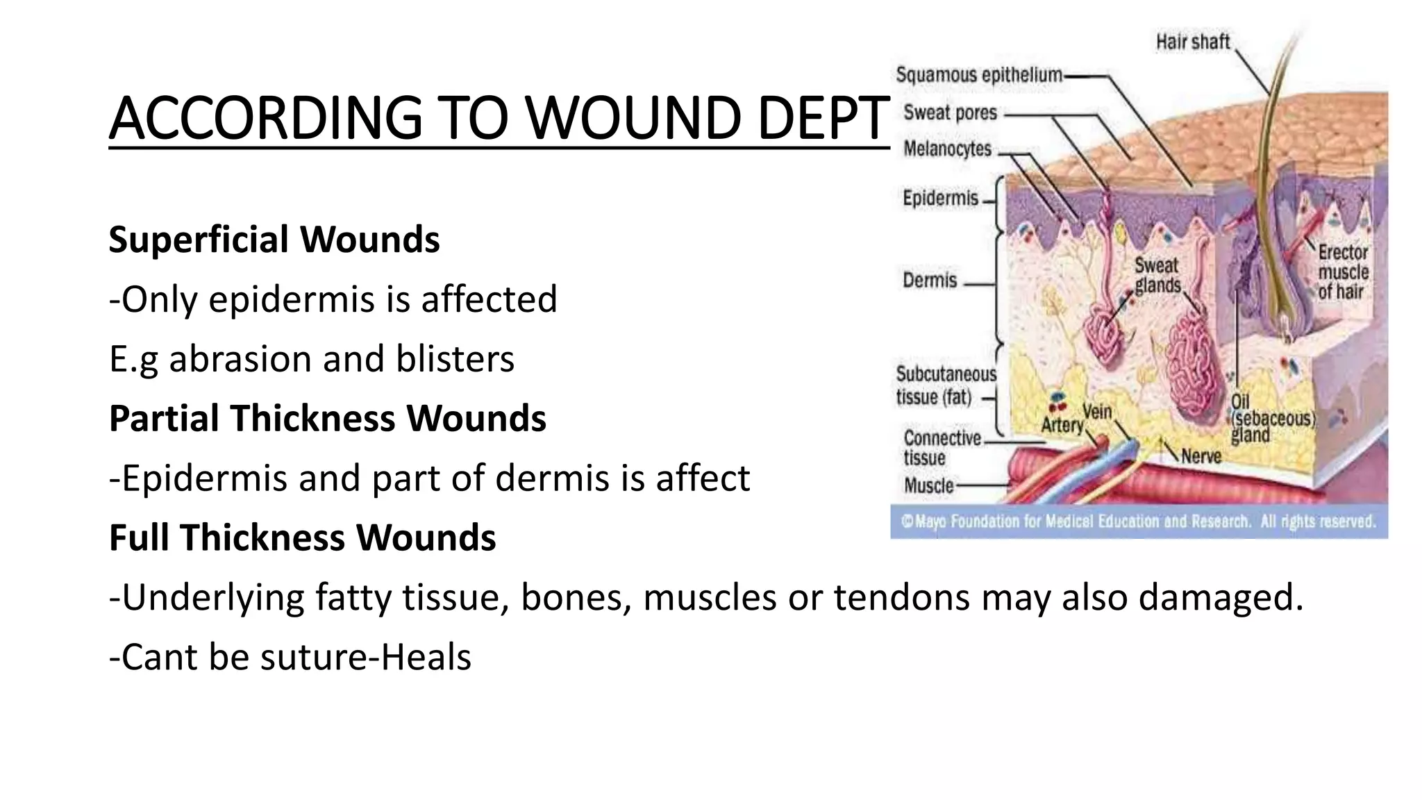 WOUNDS, WOUND HEALING AND SURGICAL SITE INFECTIONS-1.pptx