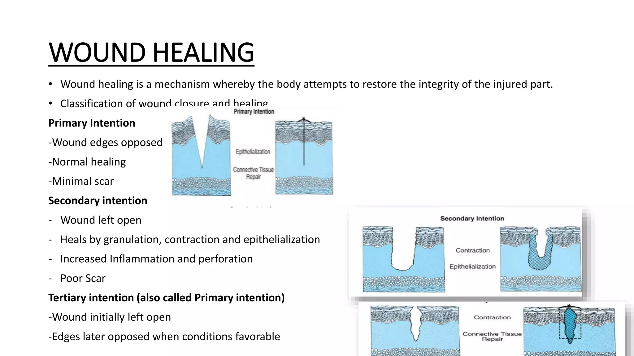 WOUNDS, WOUND HEALING AND SURGICAL SITE INFECTIONS-1.pptx