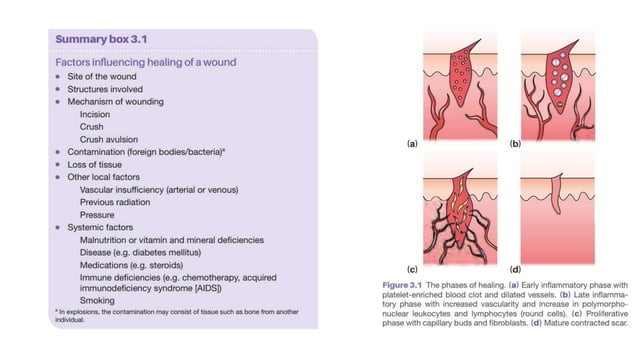 WOUNDS, WOUND HEALING AND SURGICAL SITE INFECTIONS-1.pptx