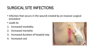 WOUNDS, WOUND HEALING AND SURGICAL SITE INFECTIONS-1.pptx