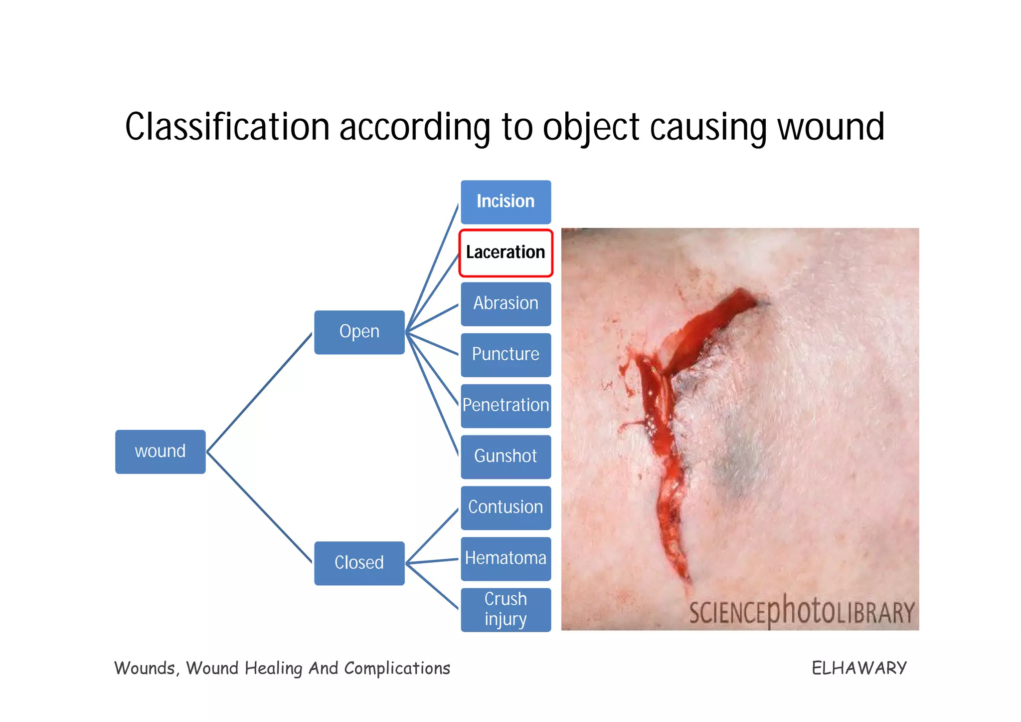 Wounds, Wound Healing And Complications | PDF