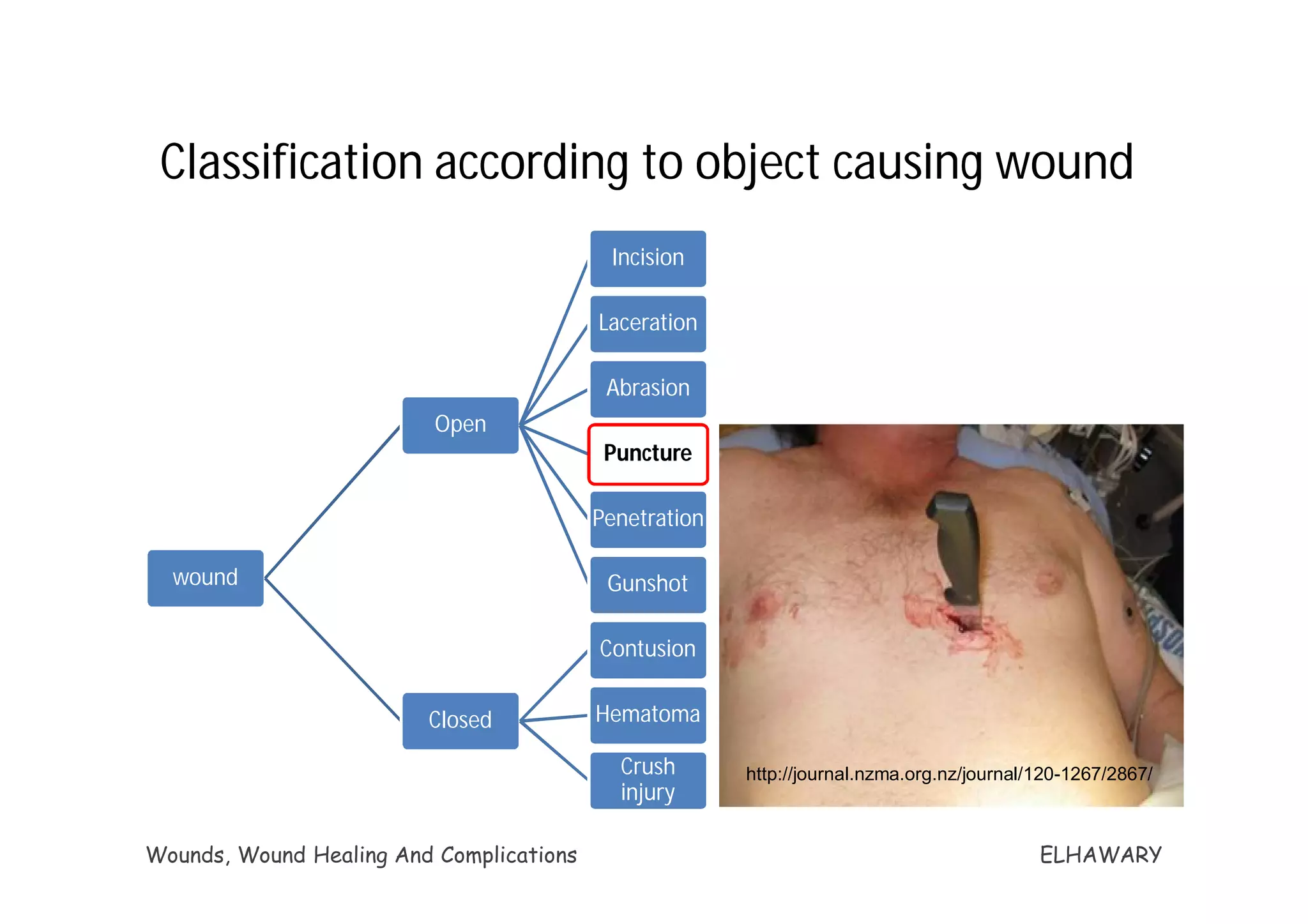 Wounds, Wound Healing And Complications | PDF