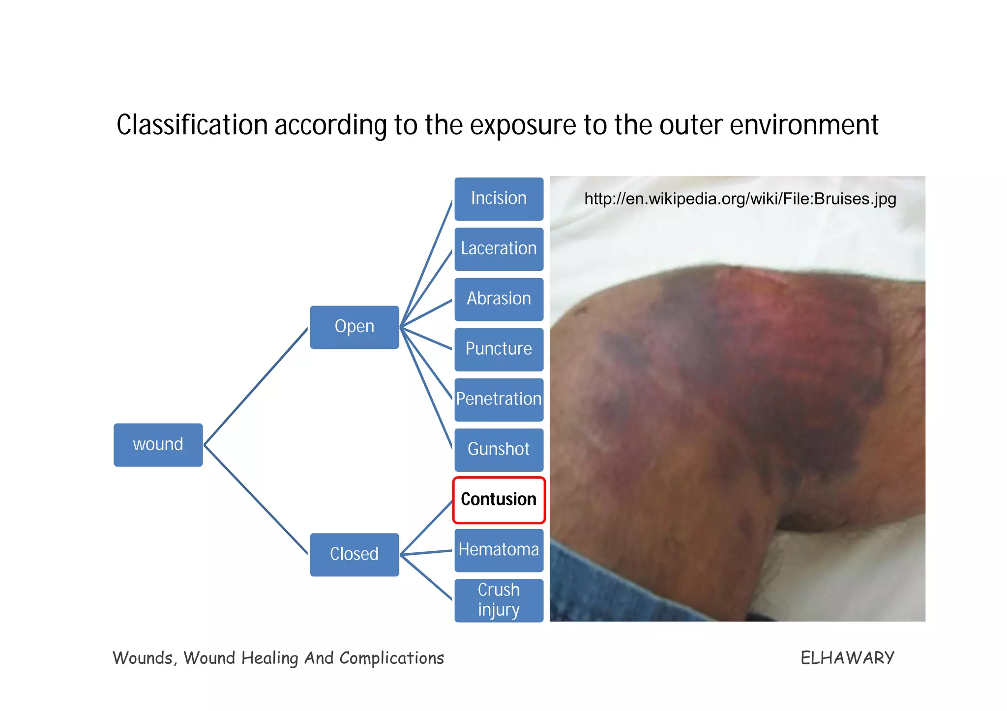 Wounds, Wound Healing And Complications | PDF
