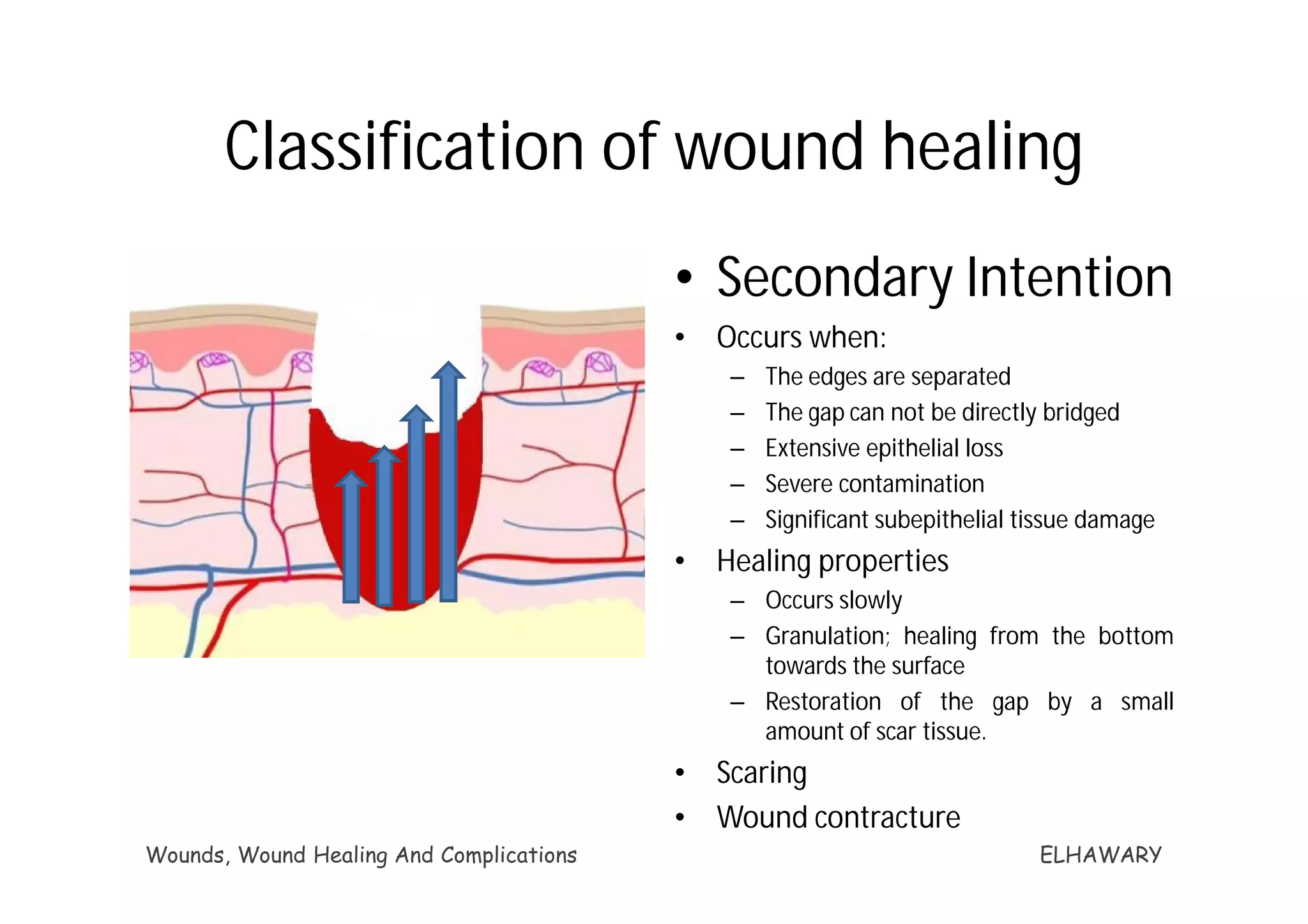 Wounds, Wound Healing And Complications | PDF