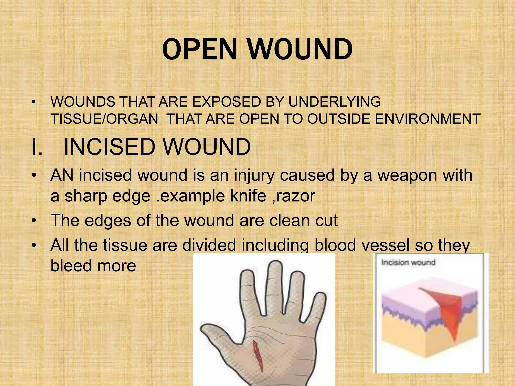 WOUND TYPE AND HEALING.pptx