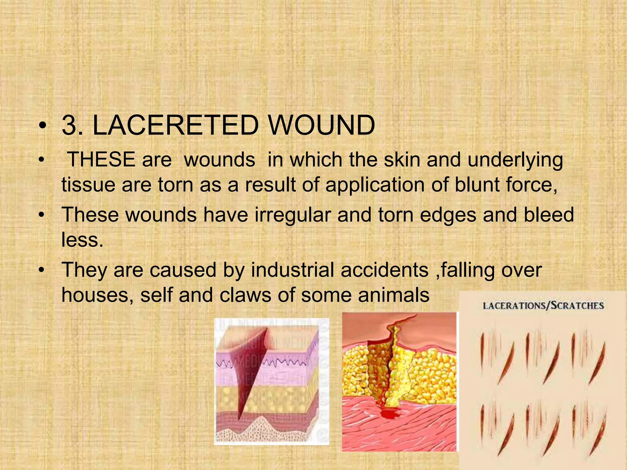 WOUND TYPE AND HEALING.pptx