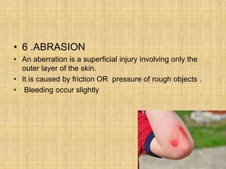 WOUND TYPE AND HEALING.pptx