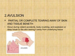 WOUND TYPE AND HEALING.pptx