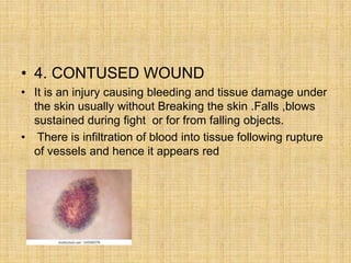 WOUND TYPE AND HEALING.pptx