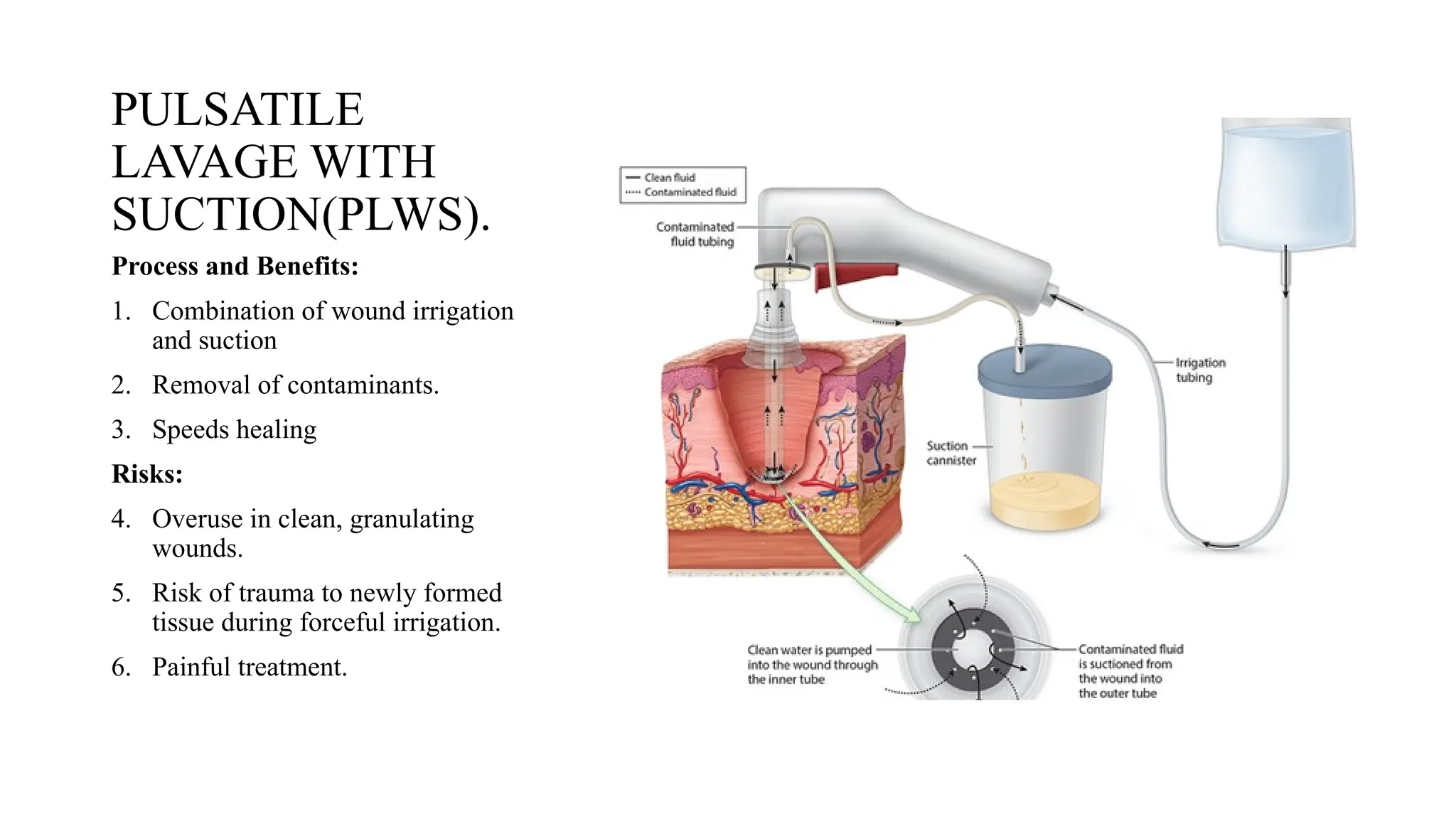 WOUND ULCERS : introduction , types, stages of healing , management ...