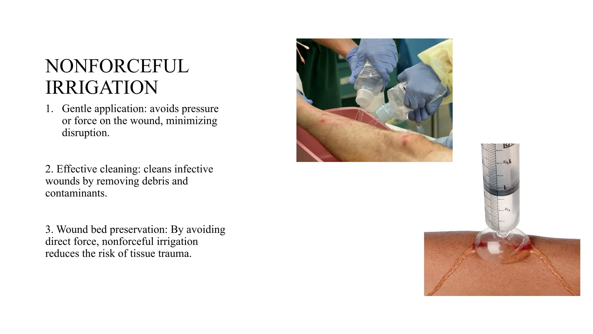 WOUND ULCERS : introduction , types, stages of healing , management ...