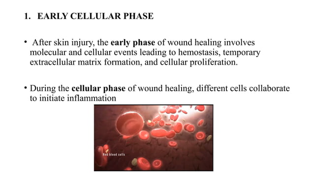 WOUND ULCERS : introduction , types, stages of healing , management ...