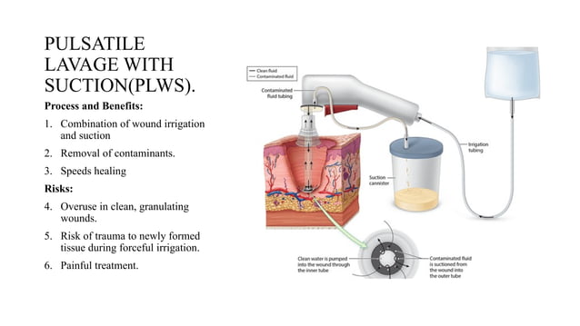 WOUND ULCERS : introduction , types, stages of healing , management ...