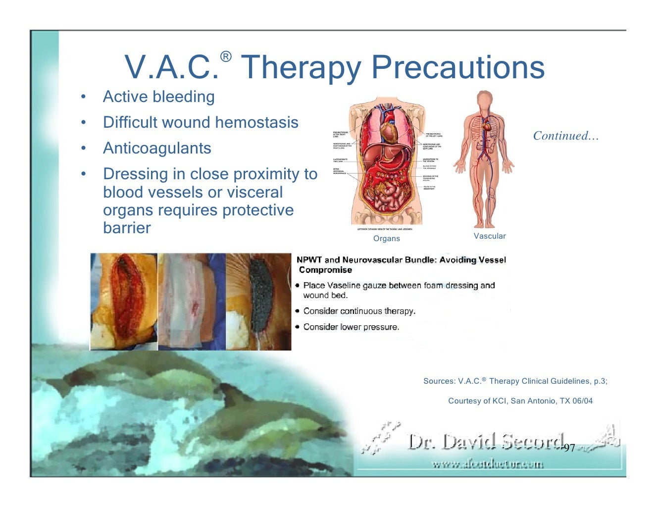 Wound Vac Lecture