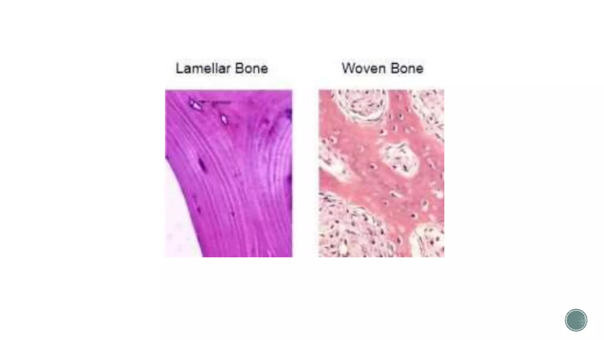 Difference between Woven bone and Lamellar bone | PPTX