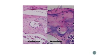 Lamellar Bone Histology