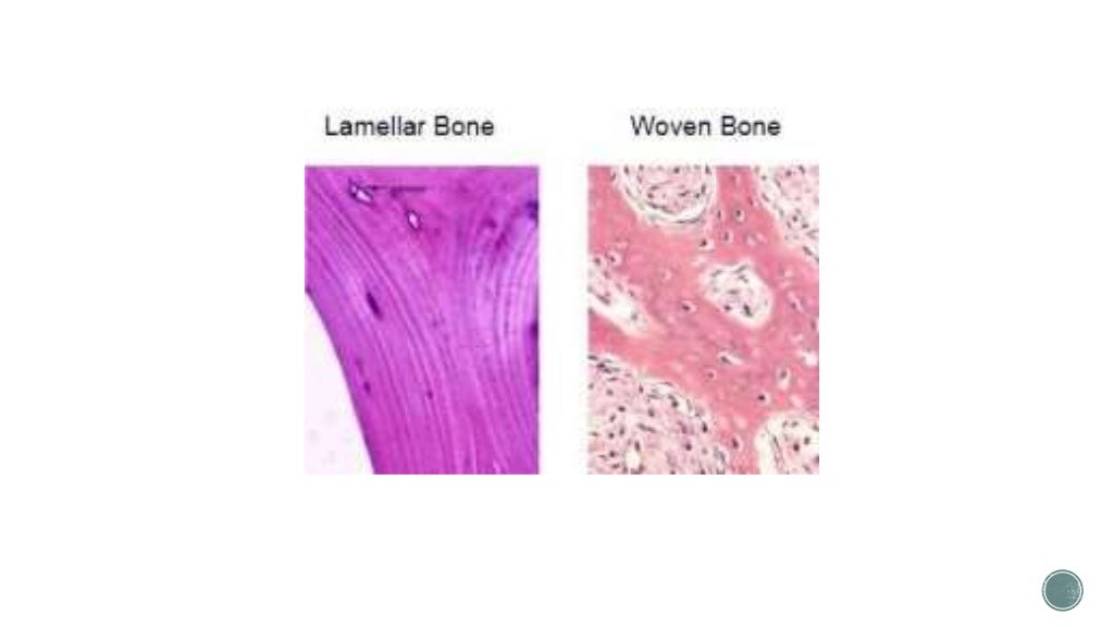 Difference between Woven bone and Lamellar bone
