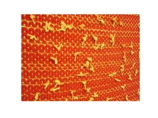 Woven inspiration | ODP