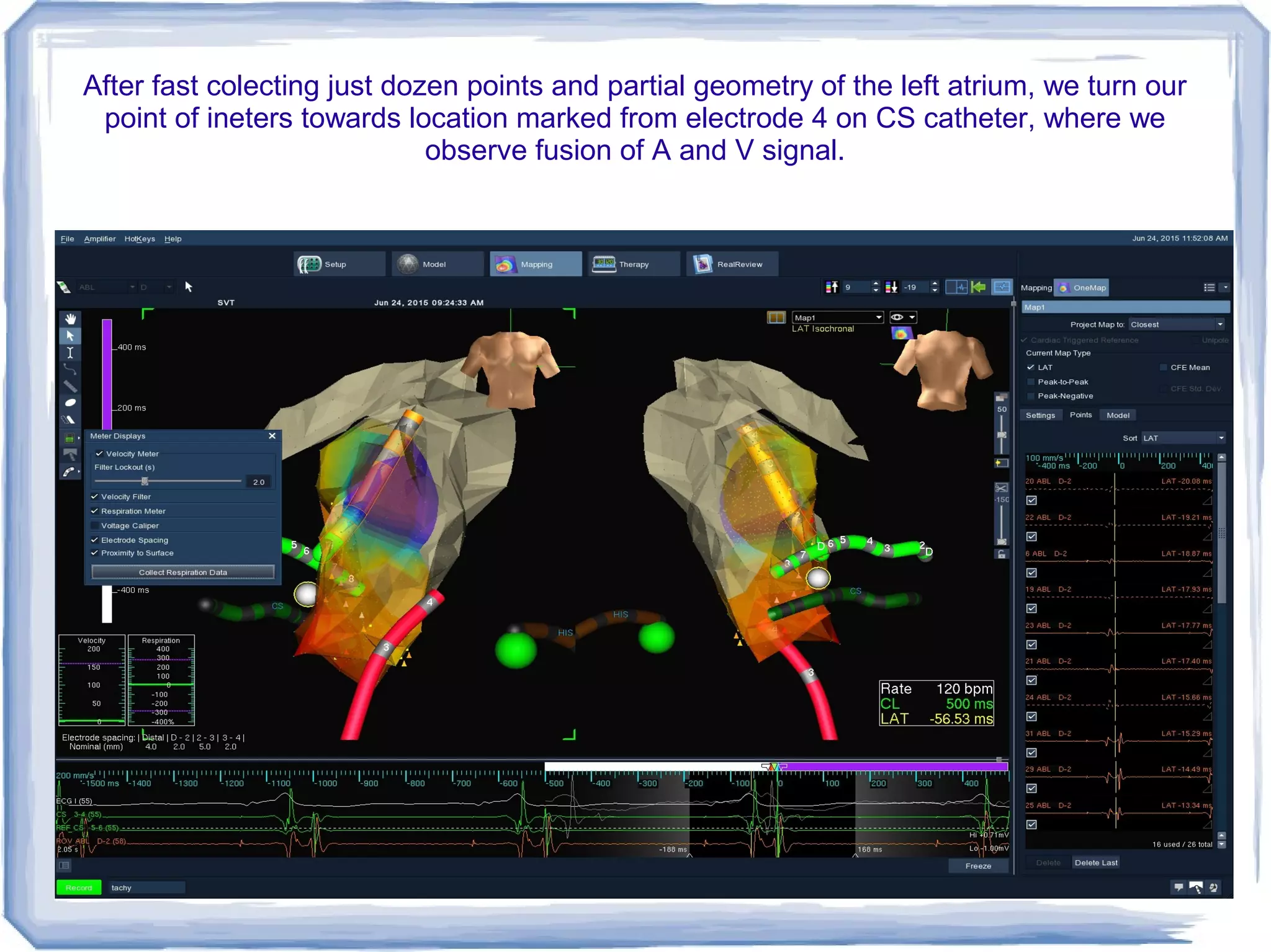 Accessories Pathway/WPW | ODP