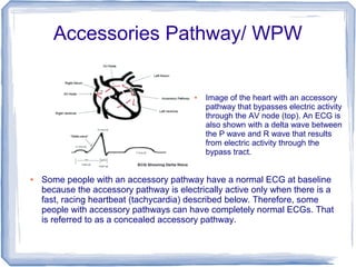 Accessories Pathway/WPW | ODP
